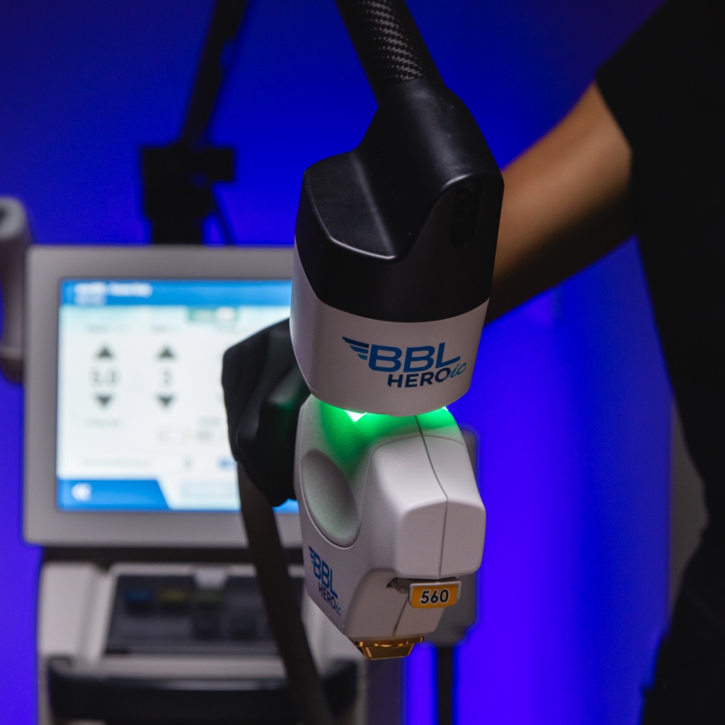BBL HEROic Laser Skin Treatment | Jacksonville, FL | Hello Smooth Med Spa